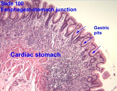 Gastroesophageal Junction Slide Labeled